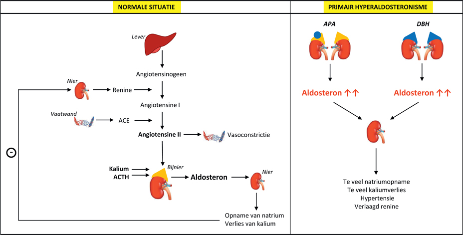 Primair hyperaldosteronisme | H&W
