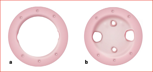 Mictieklachten na het plaatsen van een pessarium | H&W