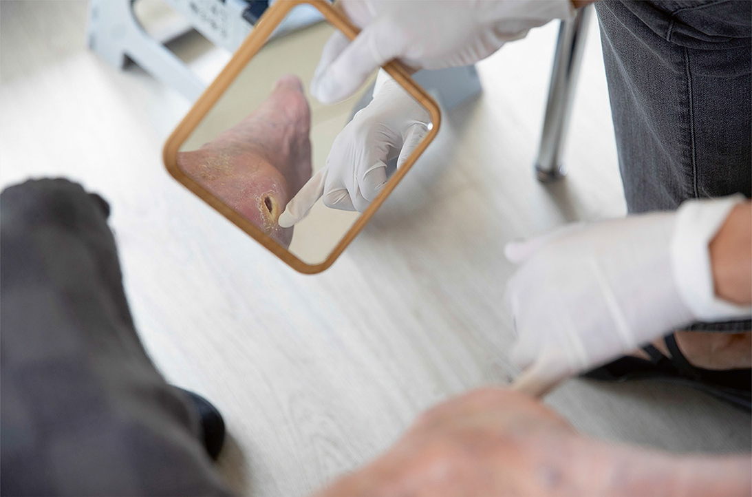 De rol van de wondverpleegkundige | H&W