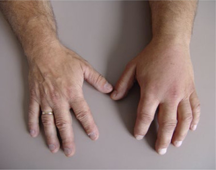 Steek van bij, wesp of hommel | H&W