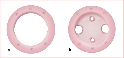Mictieklachten na het plaatsen van een pessarium | H&W