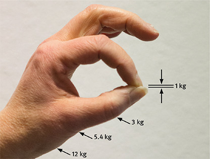 Duimbasisartrose | H&W